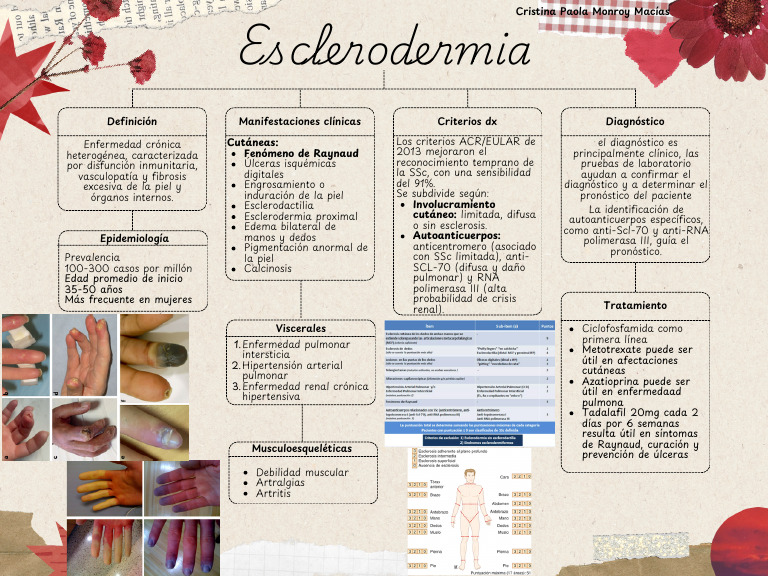 Esclerodermia | PDF | Enfermedades y trastornos | Inmunología