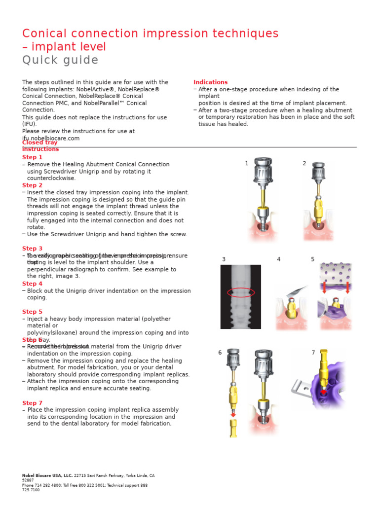 Nobel Conical Connection Impression Techniques | PDF | Dental Implant