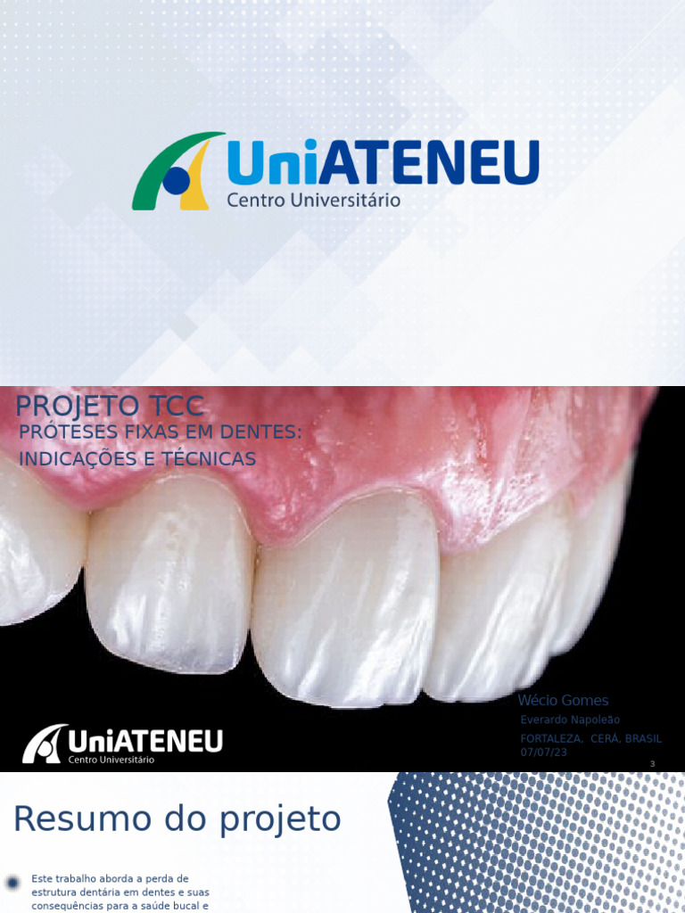 Próteses Fixas e Lentes Dentais: Análise | PDF | Dente humano | Prótese