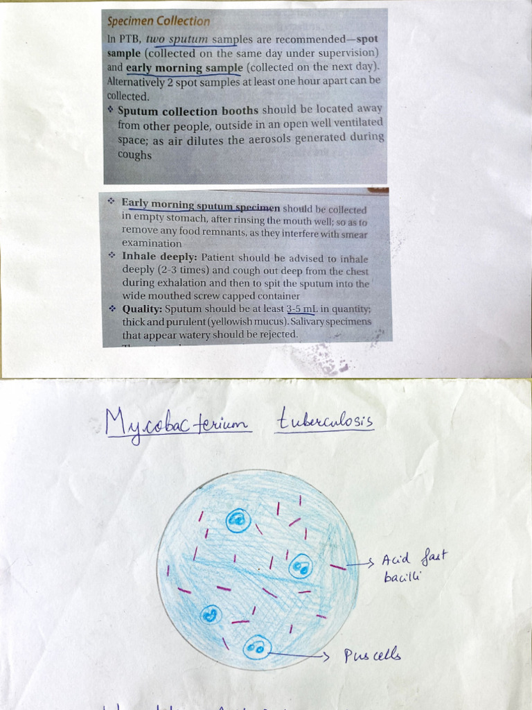Lab Diagnosis of Infection by M TB and Atypical Mycobacteria | PDF