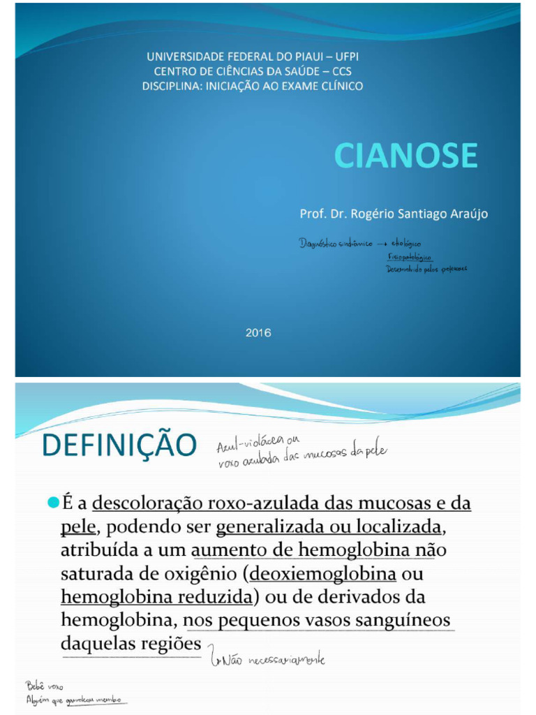 Cianose - prof Rogério (1)_230603_223811_231116_210213-compactado | PDF