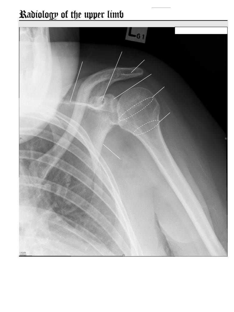 Upper Limb Radiology Overview | PDF | Limbs (Anatomy) | Musculoskeletal ...