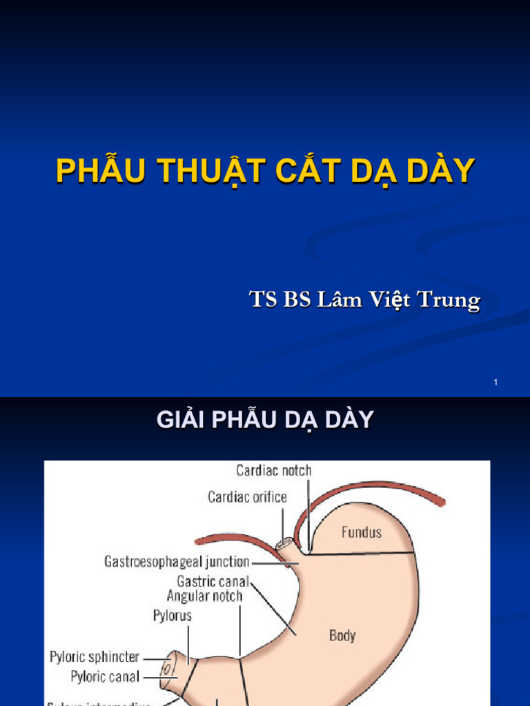 Phau thuat cat DD- bs Lam Viet Trung | PDF