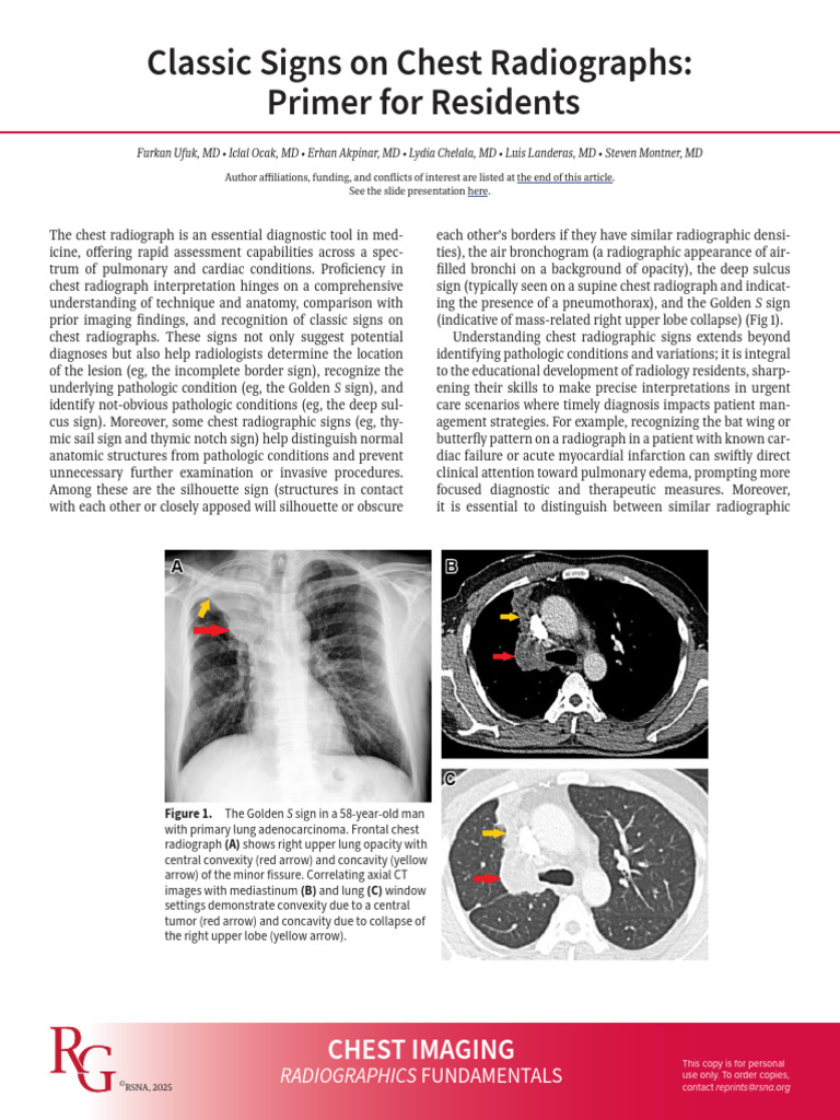 Understanding the Golden S Sign | PDF | Radiology | Radiography