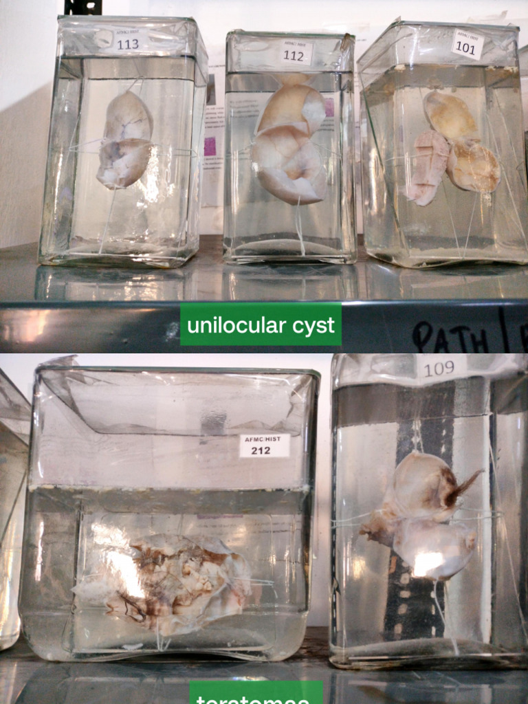 Patho Gross Specimen 2 | PDF