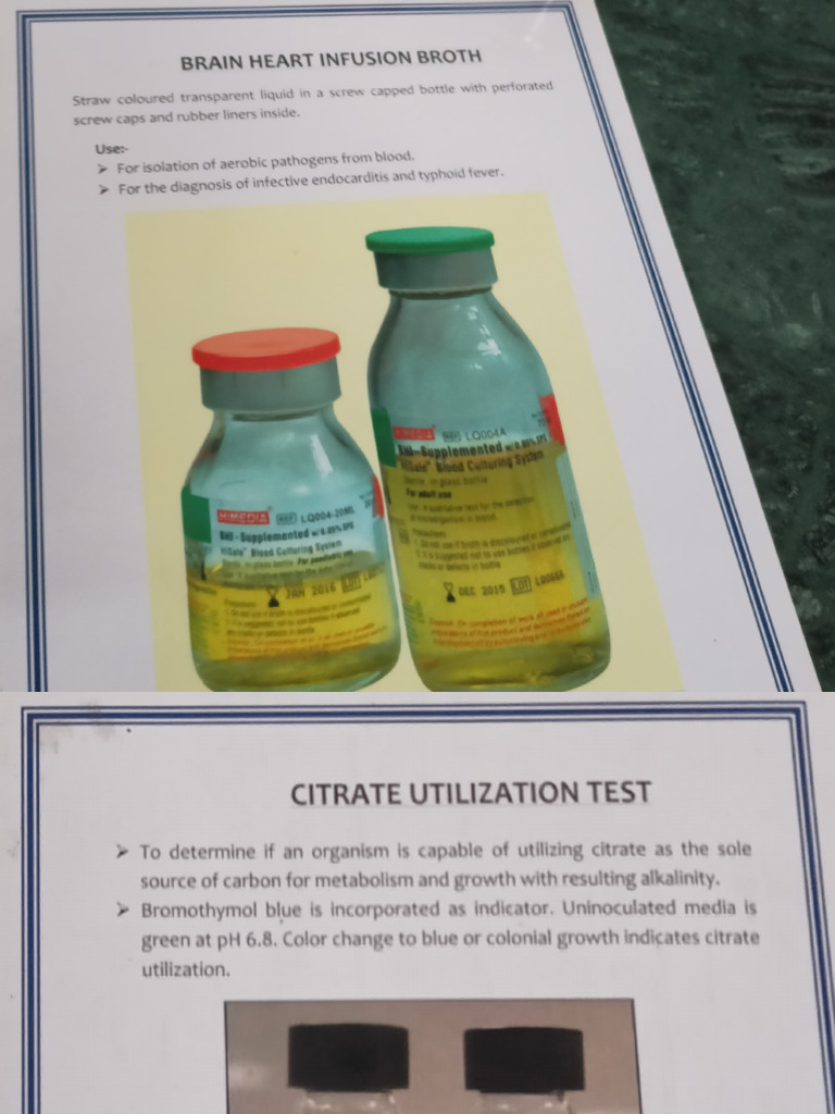 Microbiology Spotters (Final Practicals) | PDF