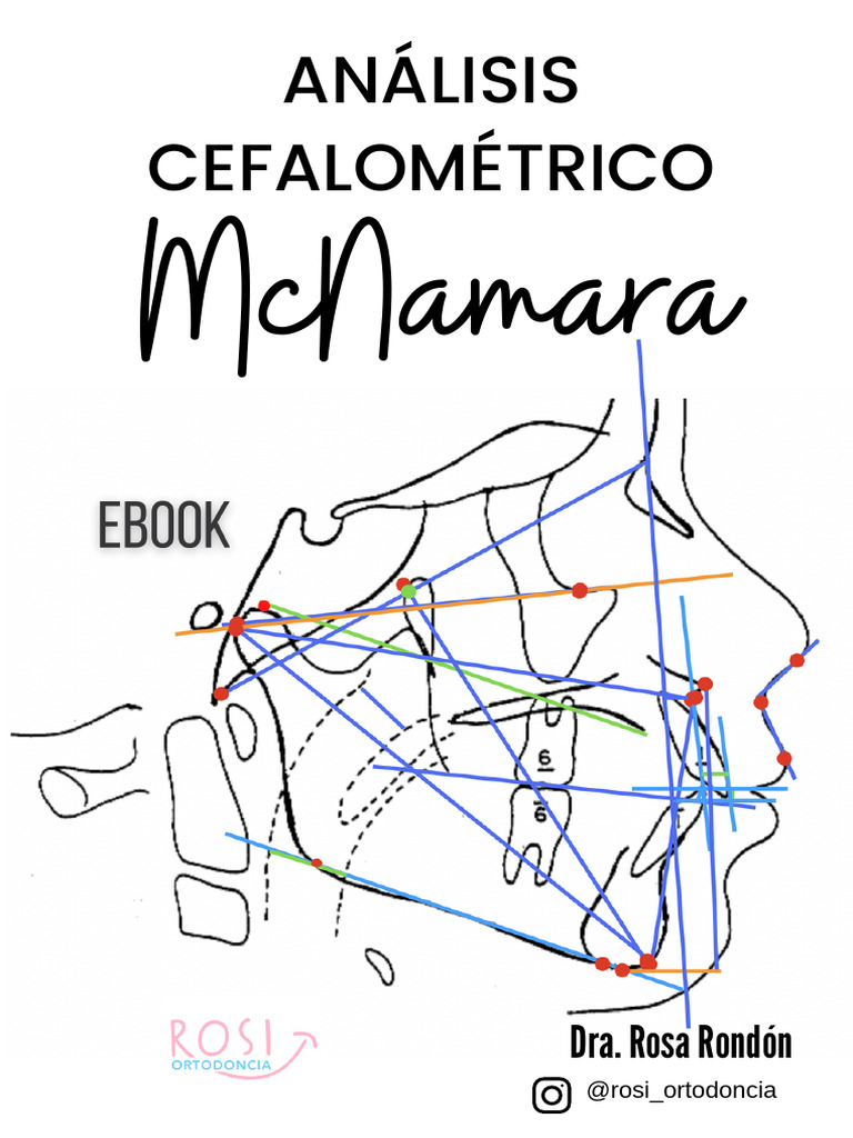 Análisis Cefalométrico Mcnamara | PDF