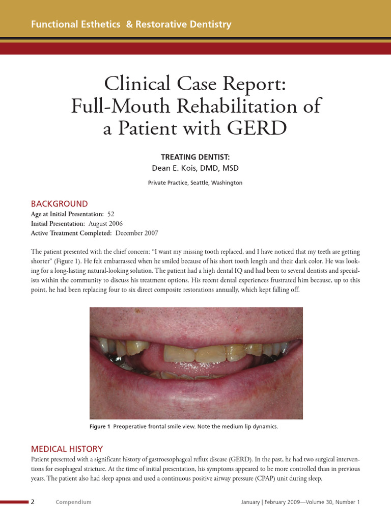 5.rehabilitacion y Arco de Kois | PDF | Human Tooth | Periodontology