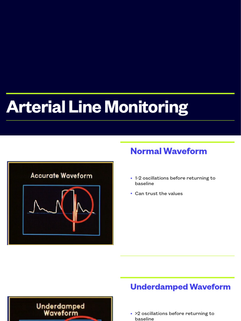 Arterial Line Monitoring | PDF