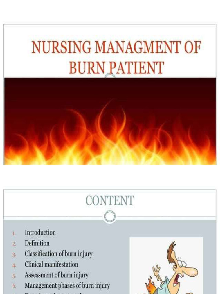 Burns Management | PDF