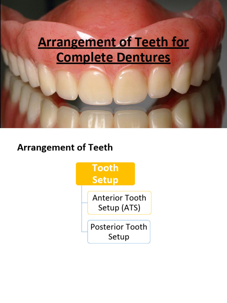 Arrangement of Teeth | PDF | Dental Anatomy | Tooth