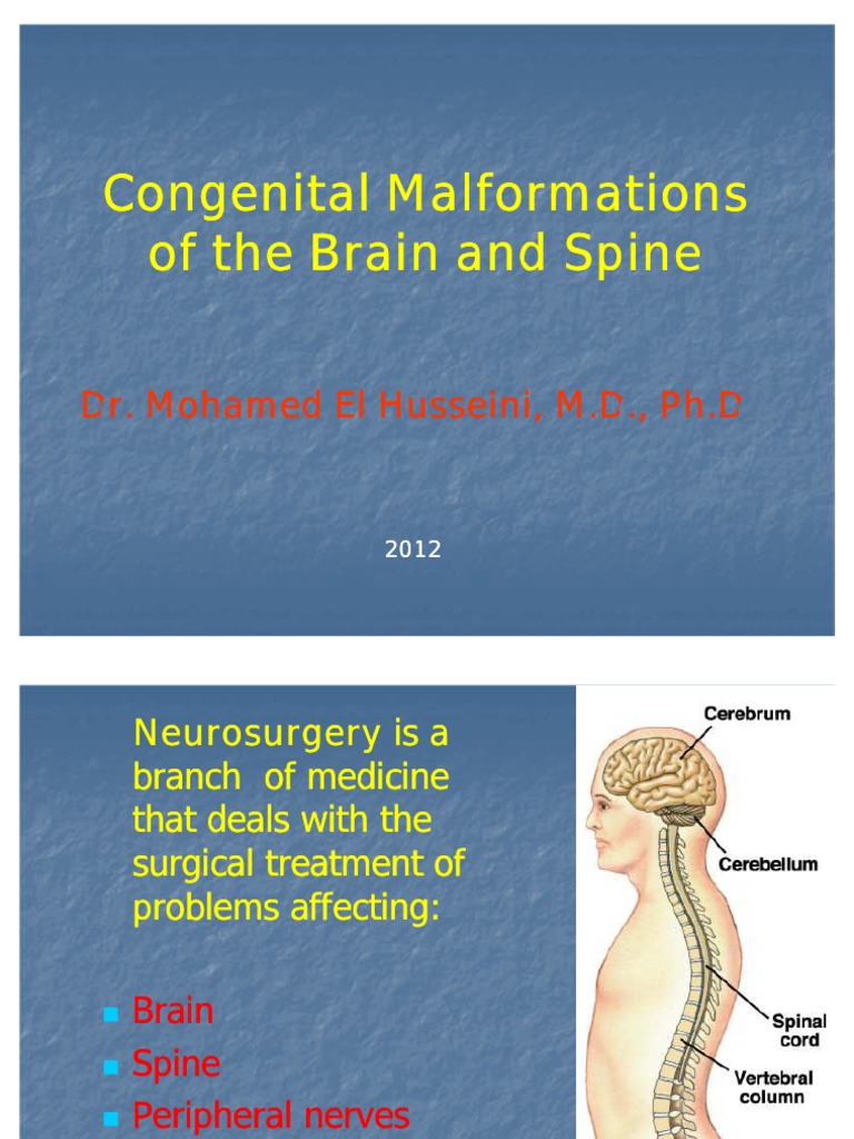 CNS Congenital Anomalies | PDF | Congenital Disorder | Human Brain