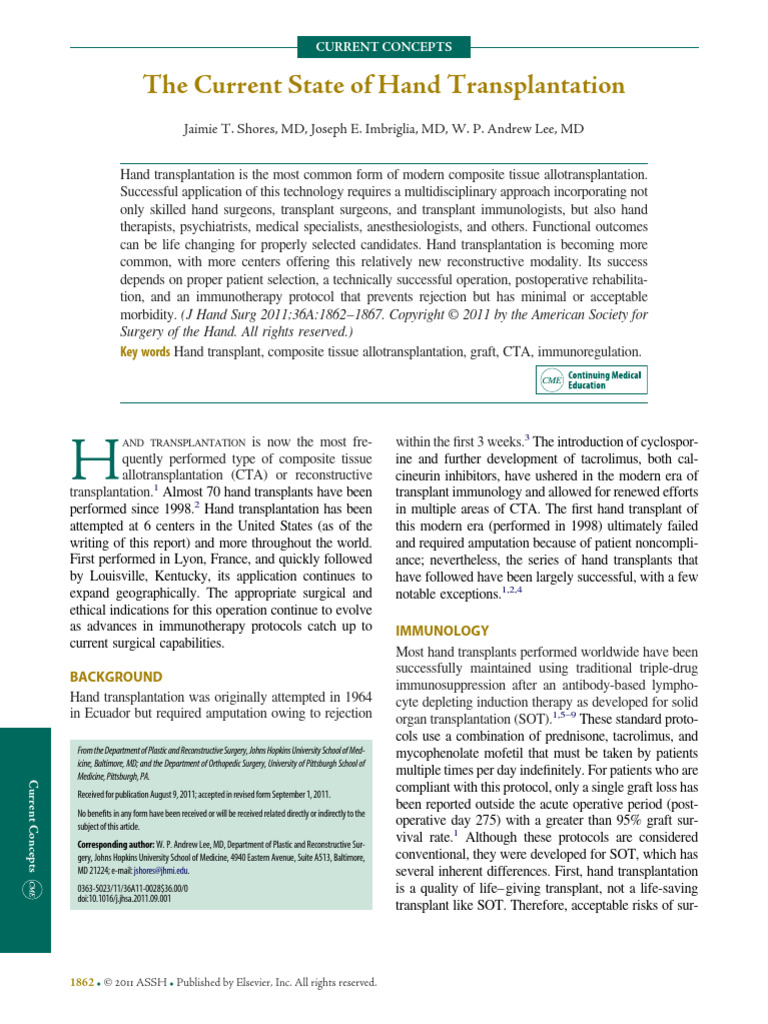 The Current State of Hand Transplantation | PDF | Transplant Rejection ...