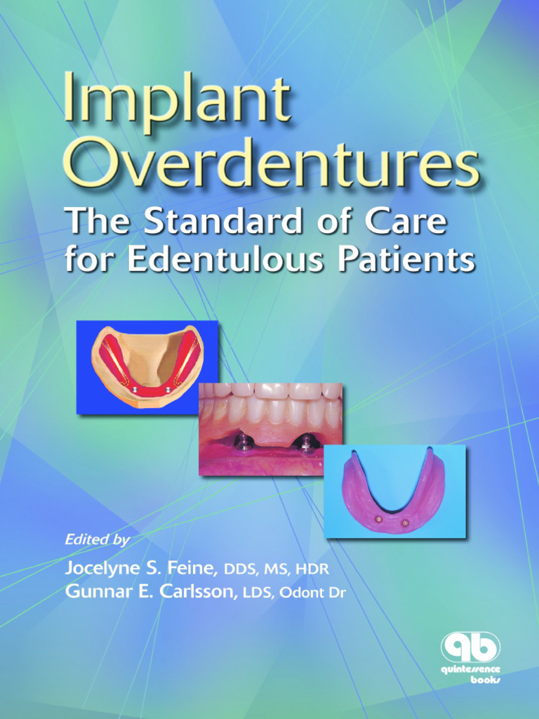 Implante Overdentures | PDF | Dental Implant | Dental Degree
