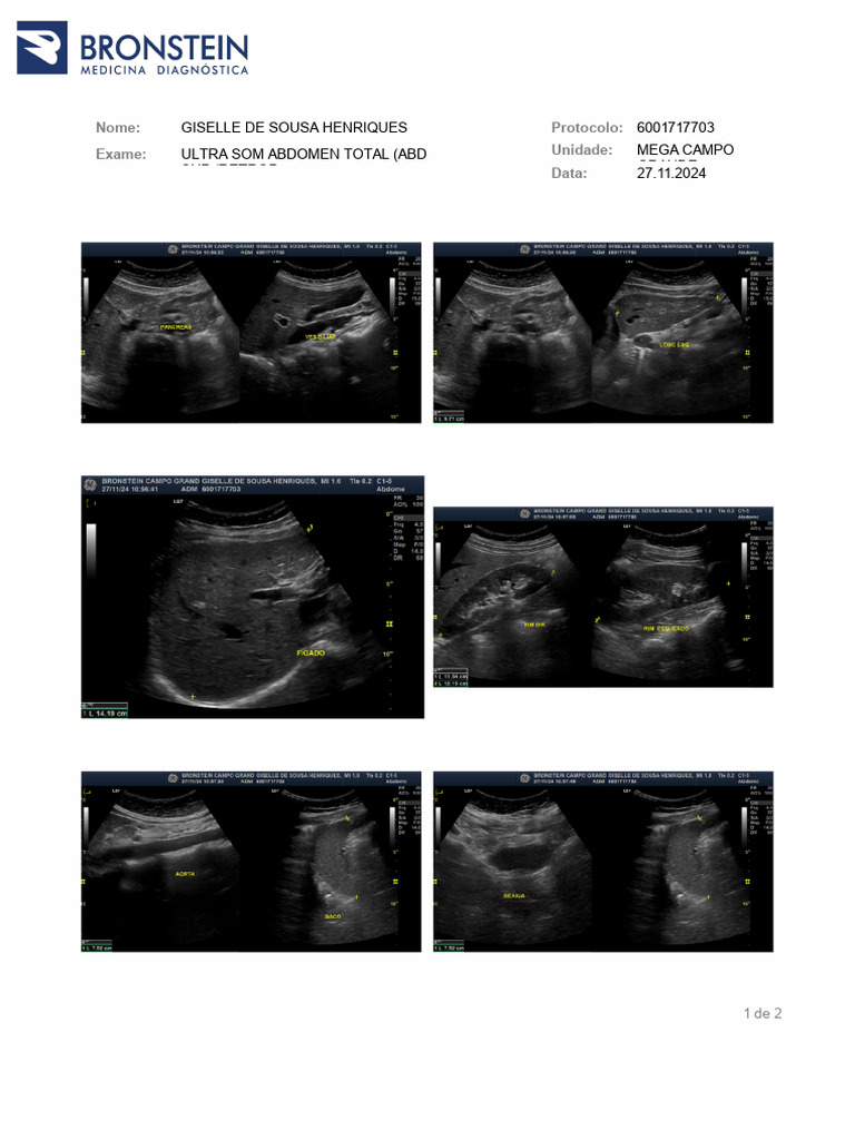 Ultrassonografia Do Abdome Total (Série de Impressão-Imagens) | PDF