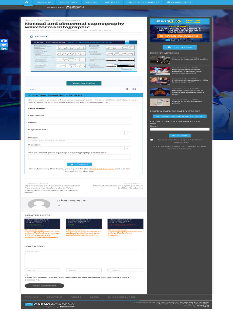Normal and Abnormal Capnography Waveforms Infographic - CapnoAcademy ...