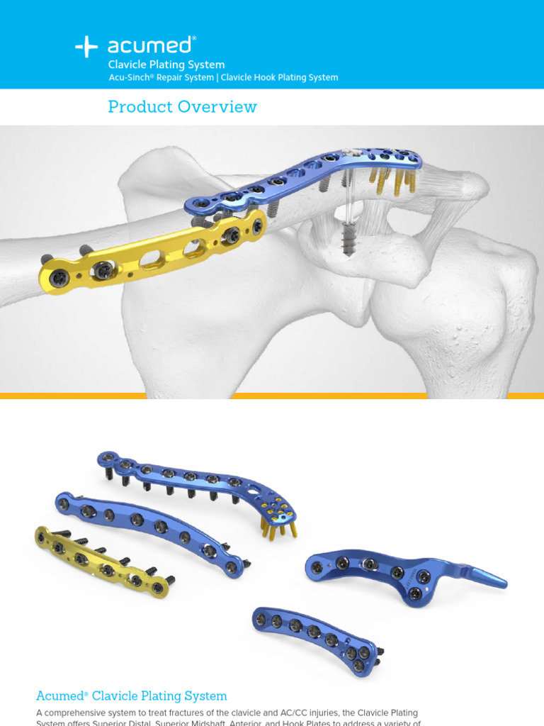 Acumed en Clavicle Plating System Brochure SHD00 04 B | PDF | Surgical ...