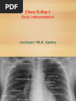 Chest X-Ray Interpretation Guide | PDF | Heart Valve | Atrium (Heart)