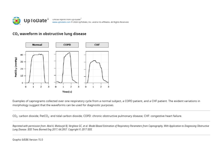 CO2 Waveform COPD - UpToDate | PDF