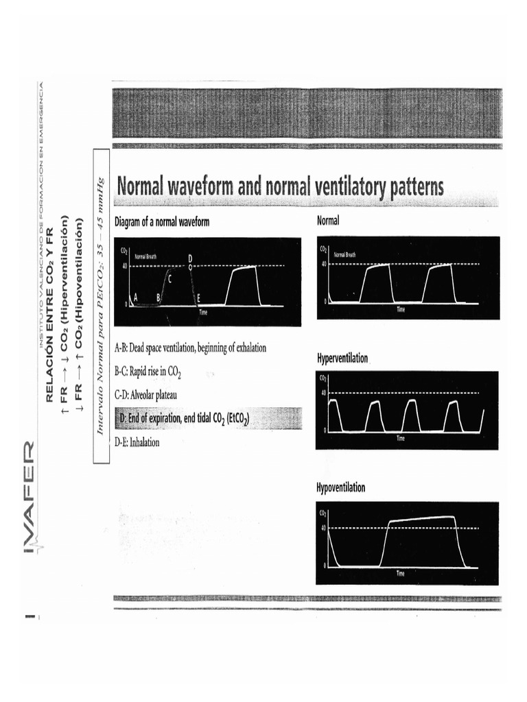 (2012) Curvas Capnografica - IVAFER | PDF