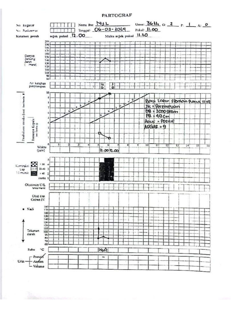partograf | PDF