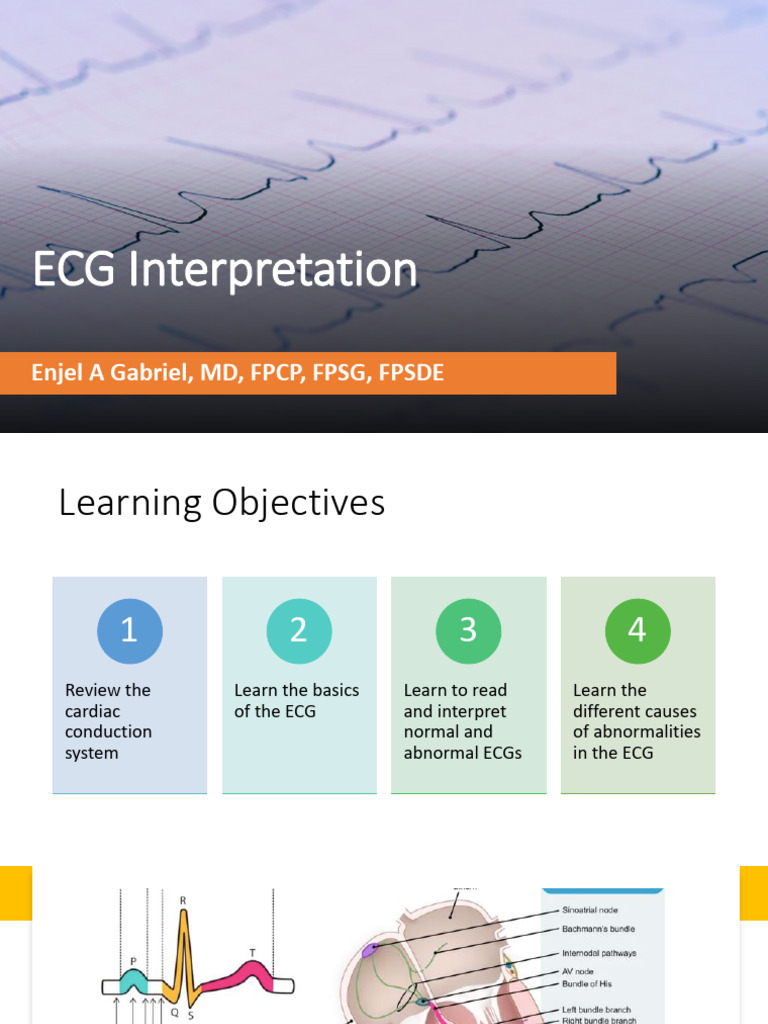IM 3.1-ECG Interpretation | PDF | Electrocardiography | Cardiac Arrhythmia