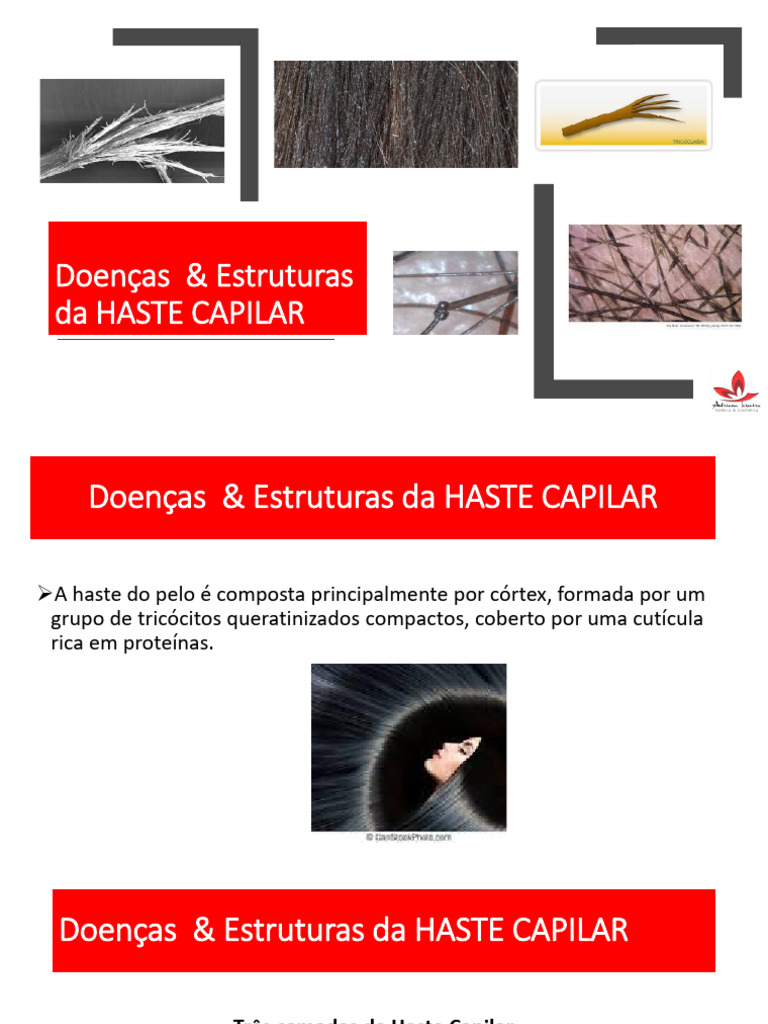 Doen_as____Estruturas_da_HASTE_CAPILAR | PDF | Cabelo