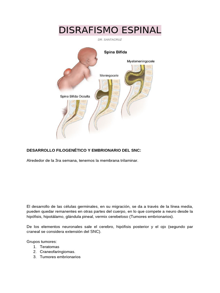 Disrafismo Espinal | PDF | Fluido cerebroespinal | Cerebro