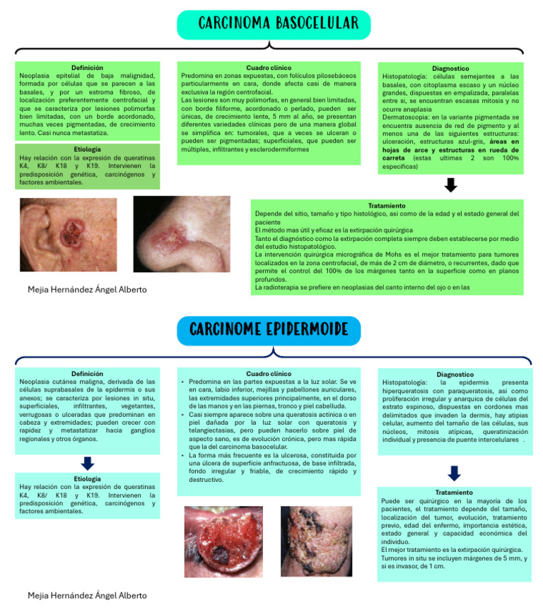 Carcinomas cutáneos: basocelular y epidermoide | PDF