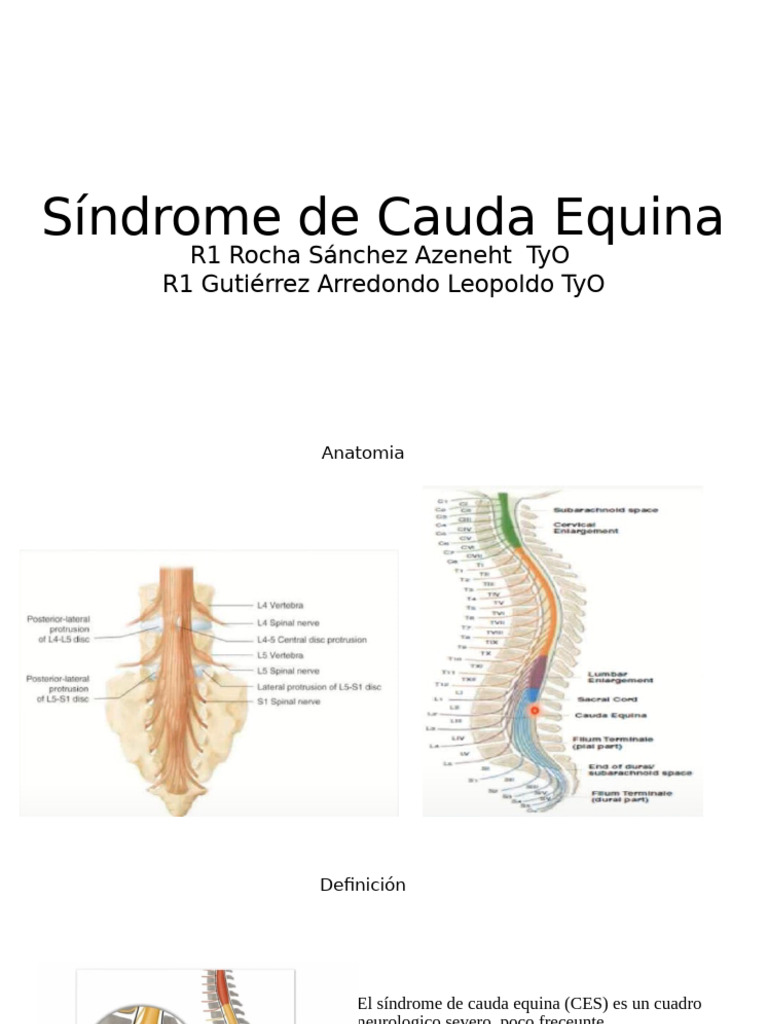 Sx Cauda Equina | PDF | Enfermedades y trastornos | Medicina CLINICA