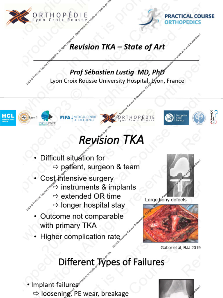 TKA Revision state of art | PDF | Surgical Specialties | Surgery
