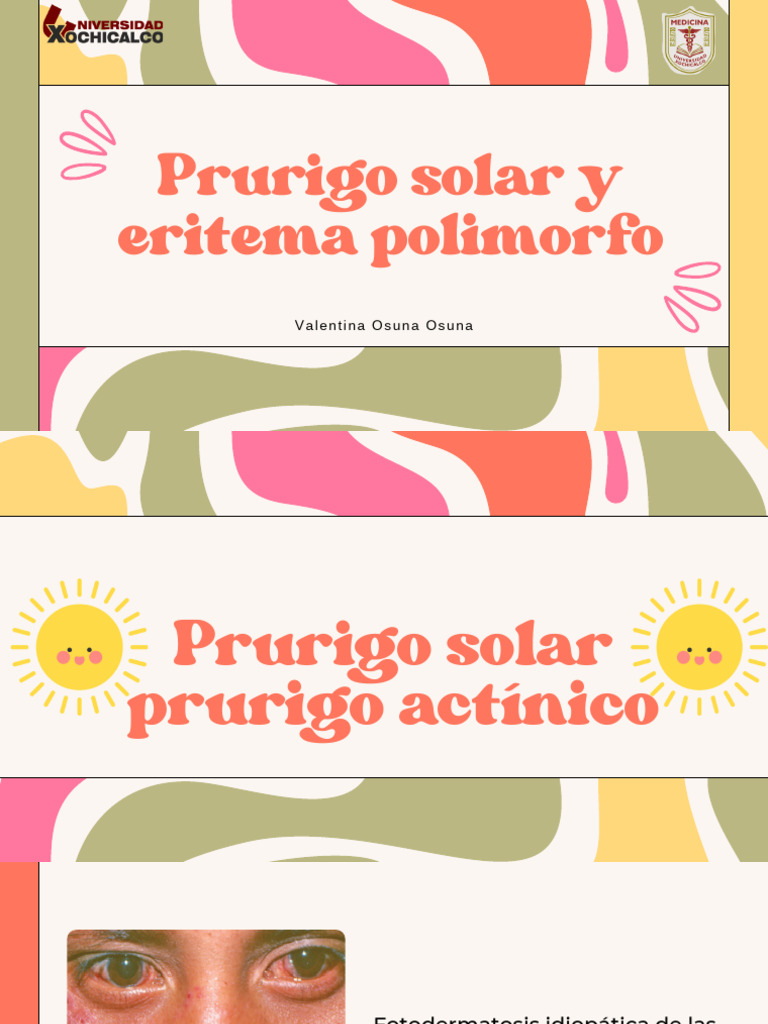 Prurigo Solar, Eritema Polimorfo-Clinicas PDF | PDF