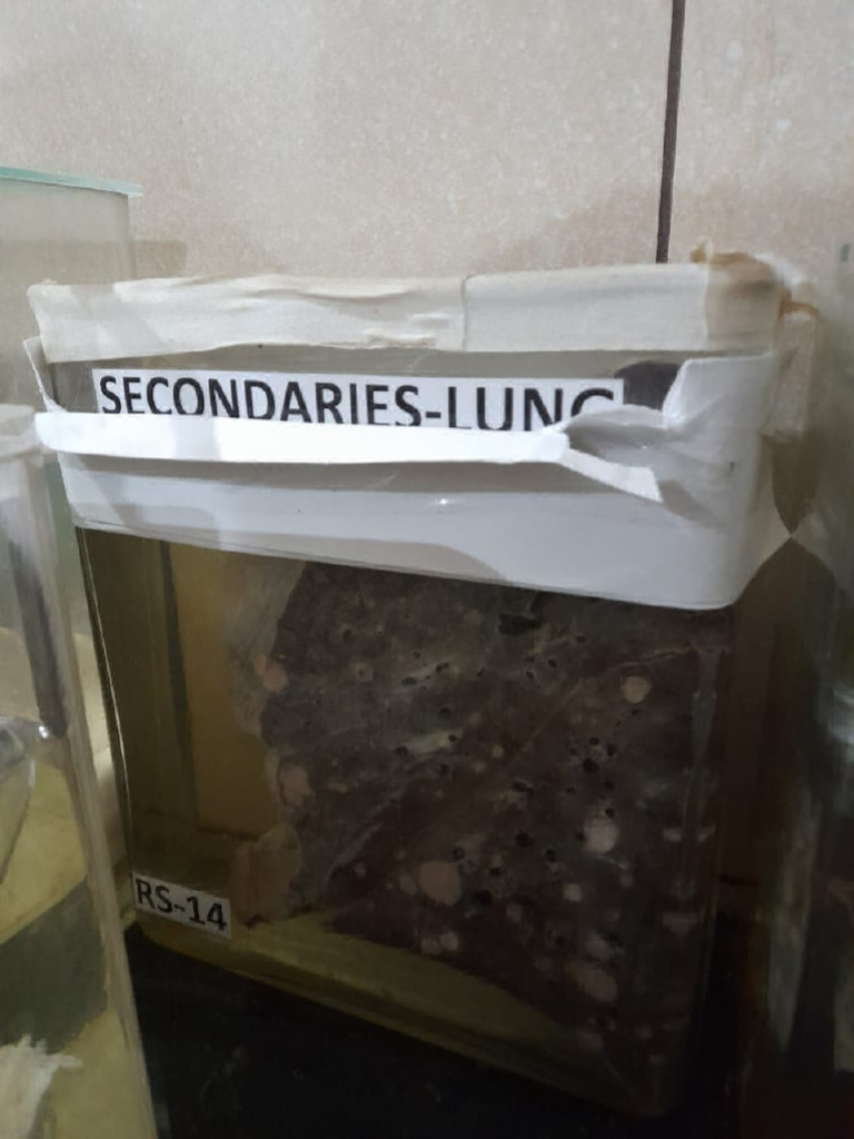 Pathology Gross Specimens 241102 001929 | PDF