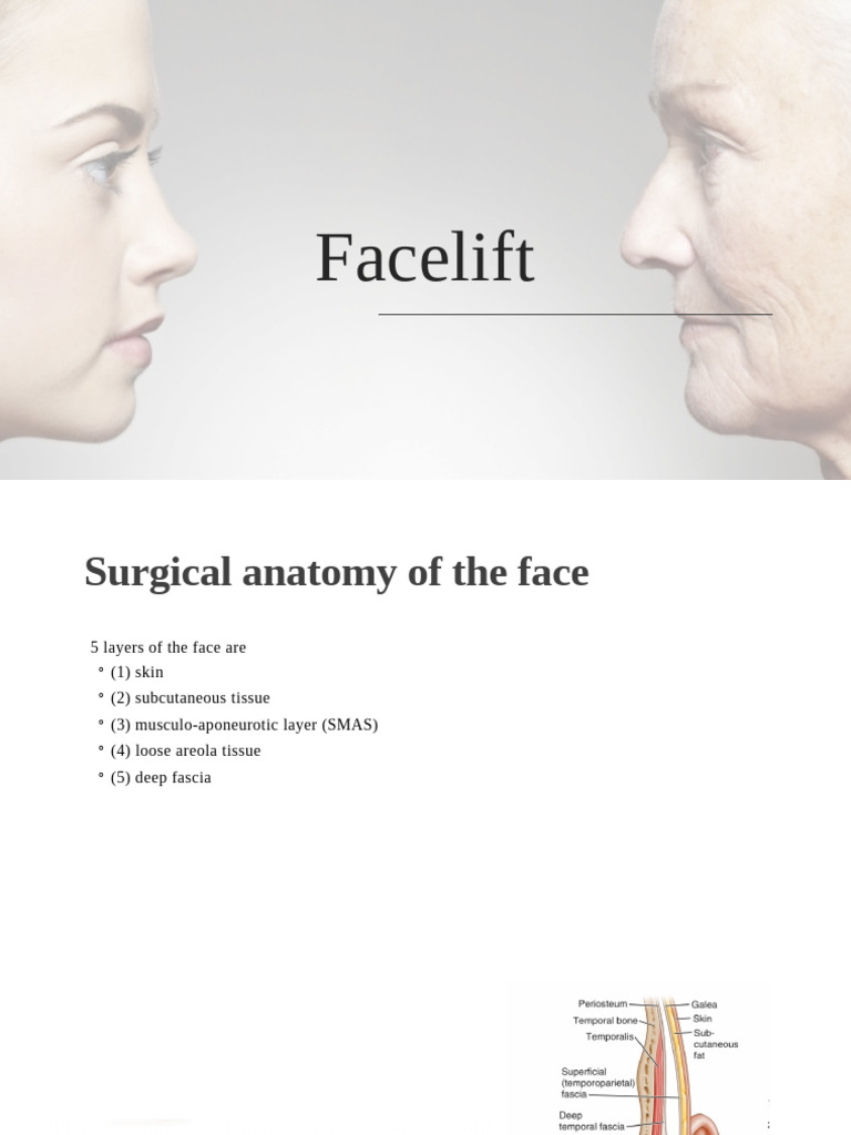 Facelift Seminar Pdf Human Anatomy Human Head And Neck