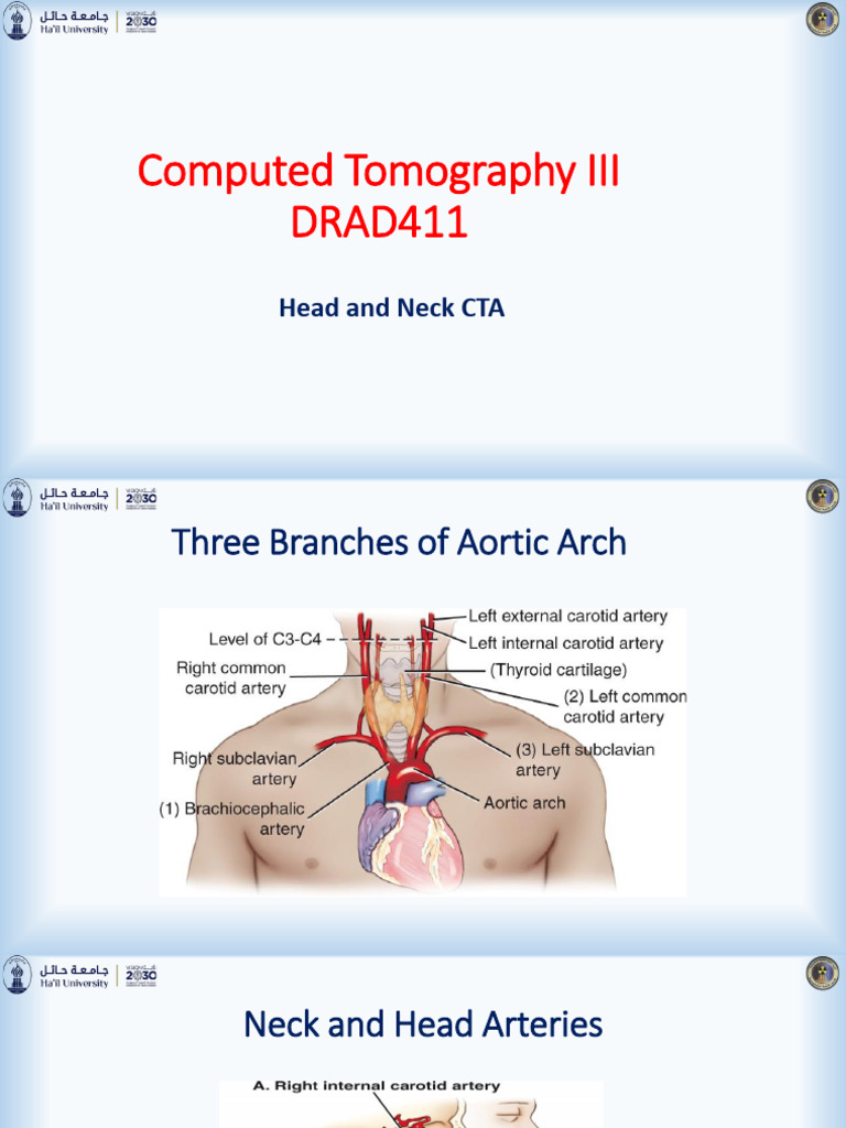 3- Head and Neck CTA | PDF | Stroke | Ischemia