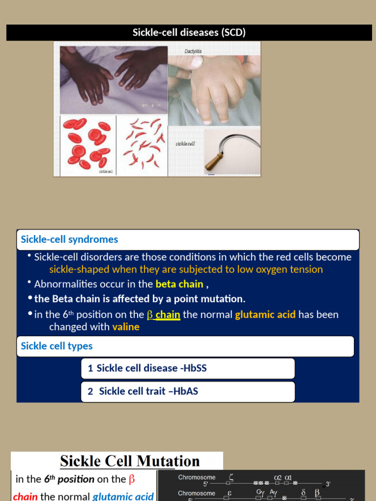Sickle Cell Anemia | PDF | Anemia | Medical Specialties