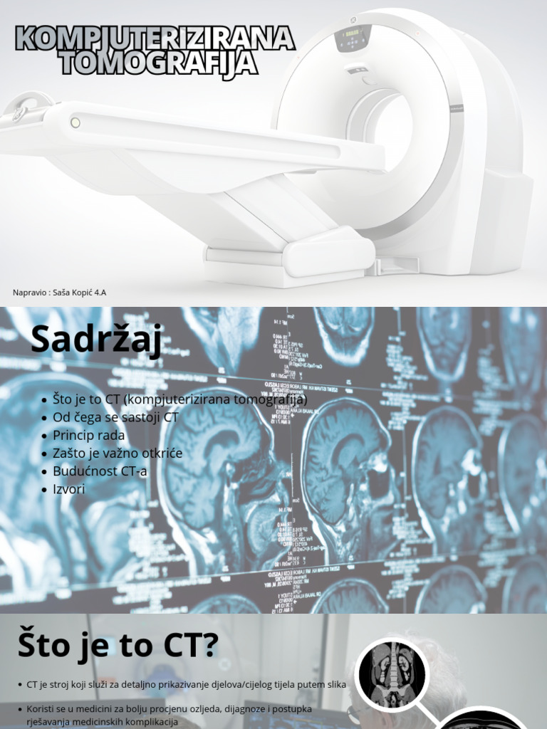 Kompjuterizirana Tomografija | PDF