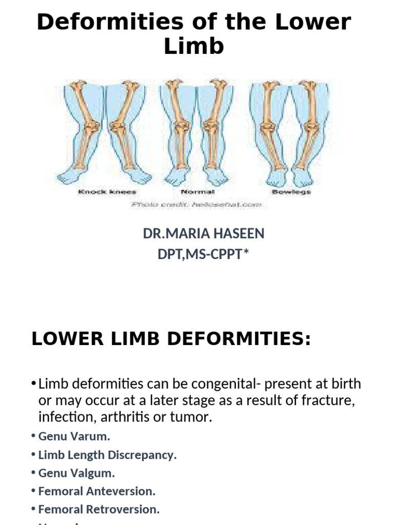 Lower Limb Deformities Surgery22 | PDF | Prosthesis | Foot