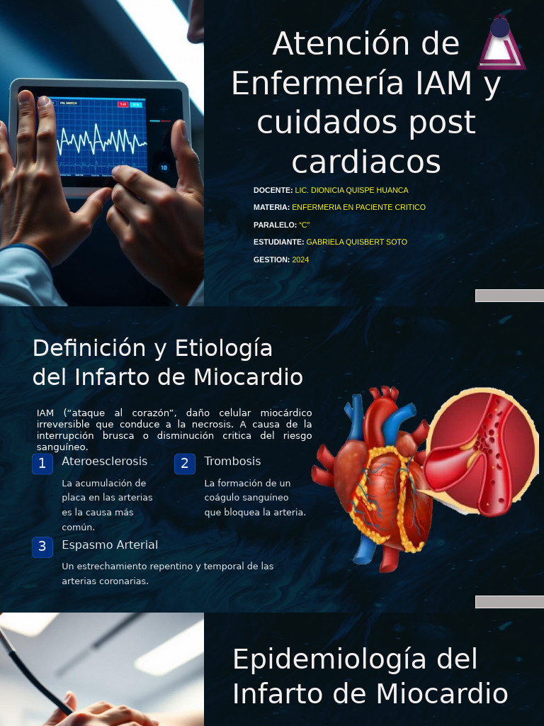 Infarto Miocardio Uti | PDF | Infarto de miocardio | Fisiología