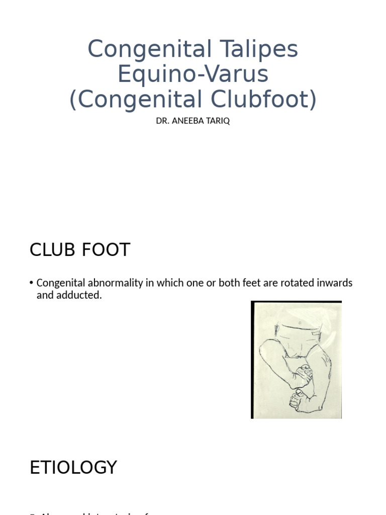 Congenital Talipes Equino | PDF