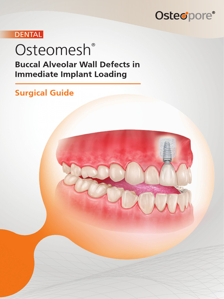Dental Osteomesh-Immediate Implant Guide (4pp) DIGITAL | PDF | Dental ...