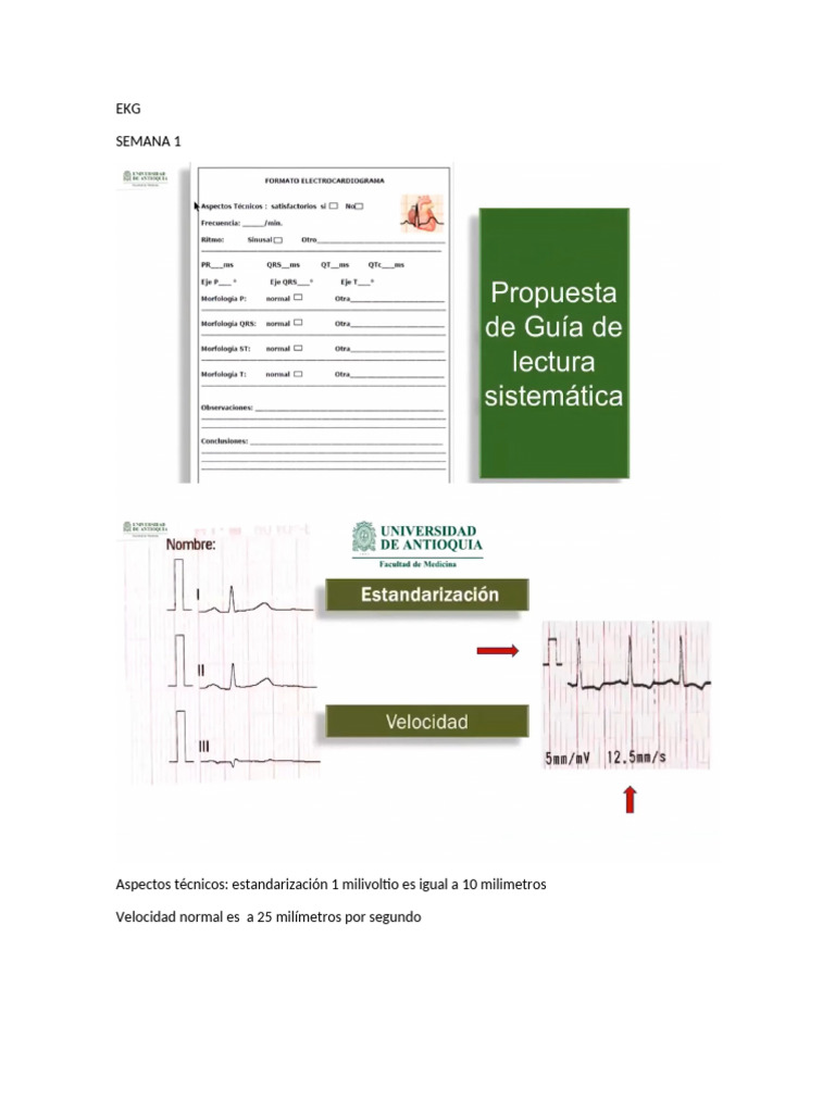 Guía de EKG: Interpretación y Análisis | PDF