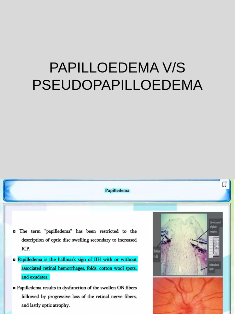 Pa Pill Oedema | PDF