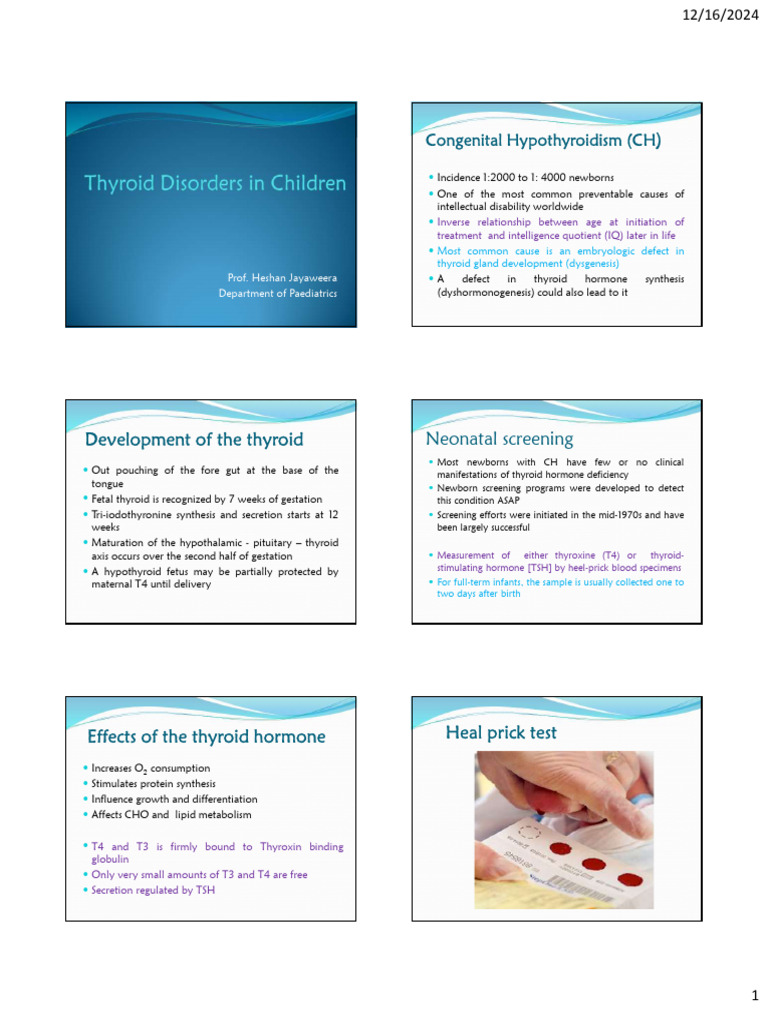 Thyroid Disorders in Children 2024 - HJ | PDF | Thyroid | Hypothyroidism
