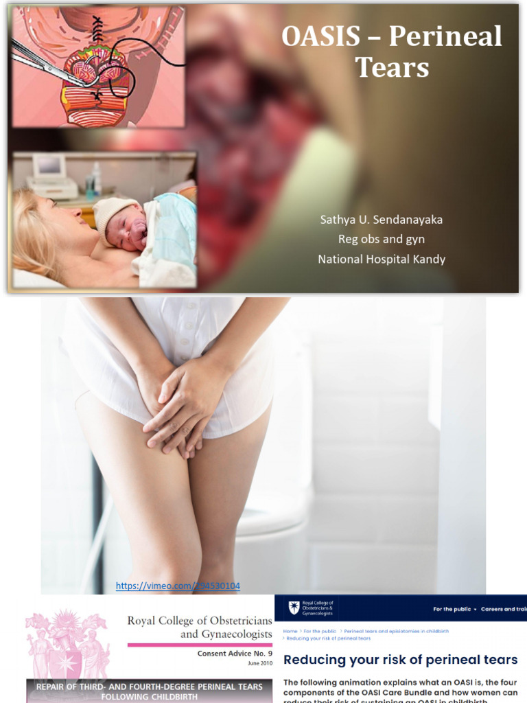 Obstetirc Perineal Injury | PDF | Childbirth | Clinical Medicine