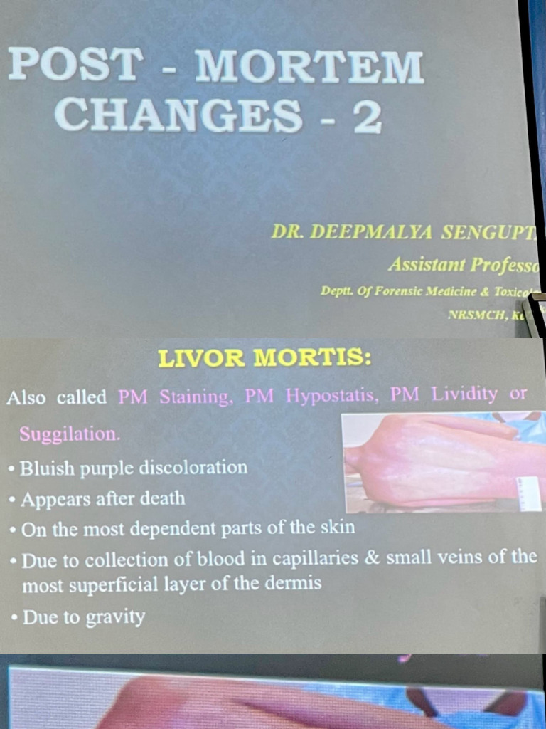 Post Mortem Changes 2 , 30 Nov 2024 | PDF