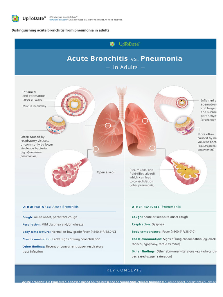 Distinguishing Acute Bronchitis From Pneumonia - UpToDate | PDF | Pneumonia | Bronchitis