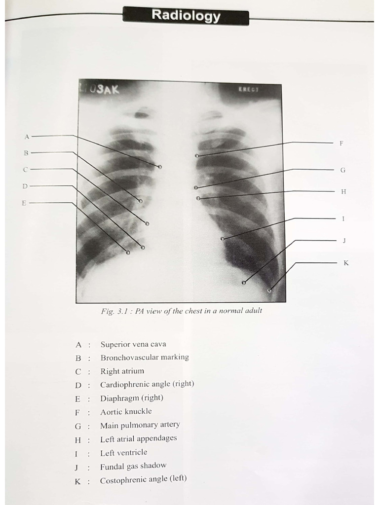 Medicine X Rays | PDF