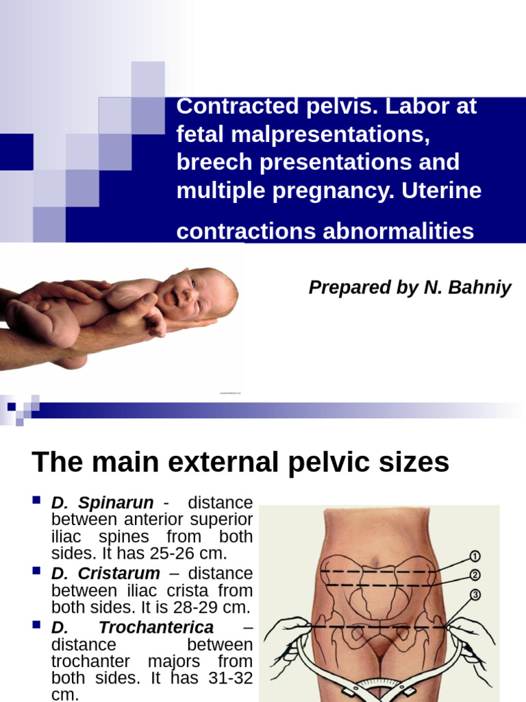 Contracted Pelvis and Labor Management | PDF | Pelvis | Childbirth