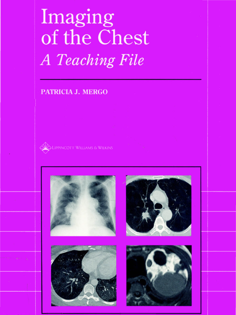 (A Teaching File) Mergo - Imaging of The Chest - A Teaching File | PDF